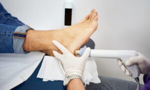 Calcaneal Spur Cure: Understanding, Treating, and Recovering from Heel Pain